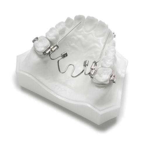 Ortho Arch – Niti Palatal Expander – Adams Med Online